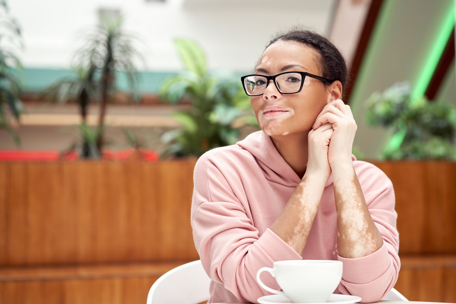 Vitiligo: What to Know? (Loss of skin color) - Vandna patel And Dr ...